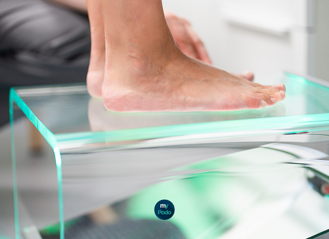 Pied plat de l’adulte : Comprendre, diagnostiquer et traiter cette ...